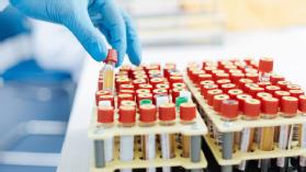 ASCP Exams & ASCP Exam Test Prep | Study.com